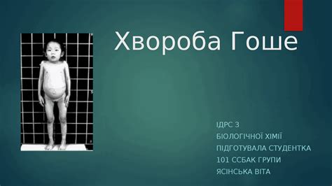 Презентація опис Хвороба Гоше Презентации Медицинская биохимия Docsity