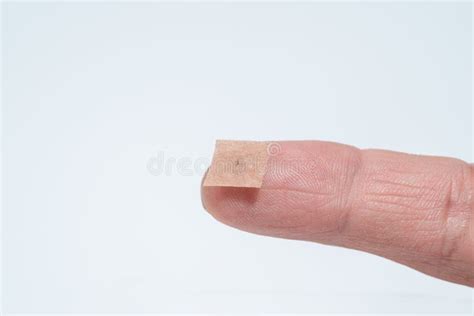 Auriculotherapy Also Auricular Therapy Ear Acupuncture And