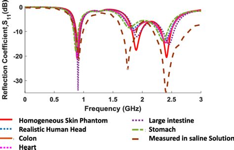 Figure 1 From A Miniaturized Triple Band Implantable Antenna System For Bio Telemetry