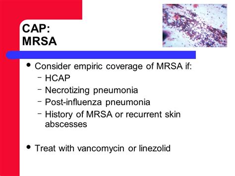 Idsaats Guidelines On Community Acquired Pneumonia In Adults Patty W