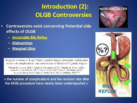 Conversion Of Omega Loop Gastric Bypass To Rouxeny
