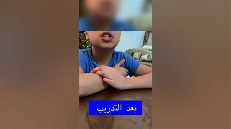 اللدغة السينية تخاطب Youtube