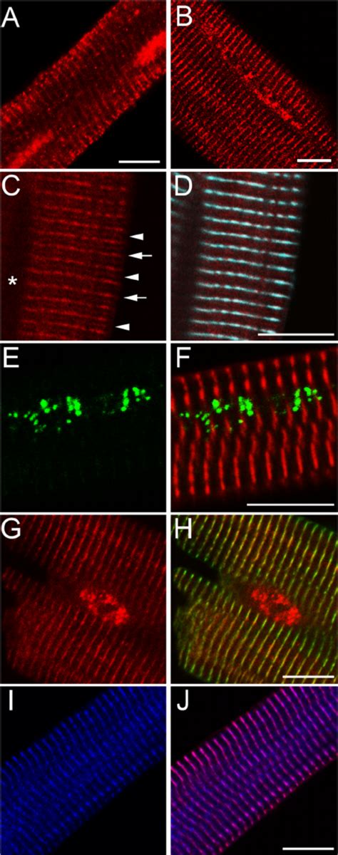 Differential Subcellular Localization Of Pp2a Regulatory Subunits In