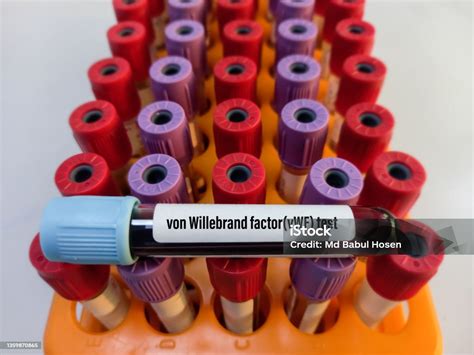 Blood Sample For Von Willebrand Factor Antigen Test Clotting Factor