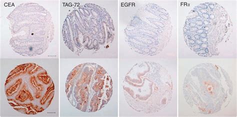 representative tissue microarray cores of normal colorectal tissue top
