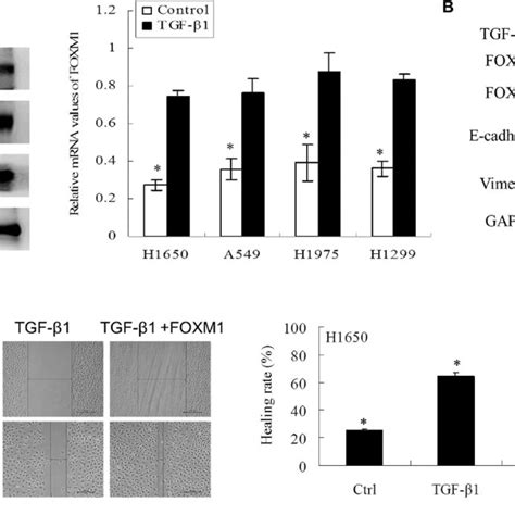 Foxm1 Enhanced Tgf B1 Induced Emt In Nsclc Cells A Nsclc Cells