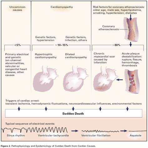 arrêt cardio respiratoire Flashcards Quizlet