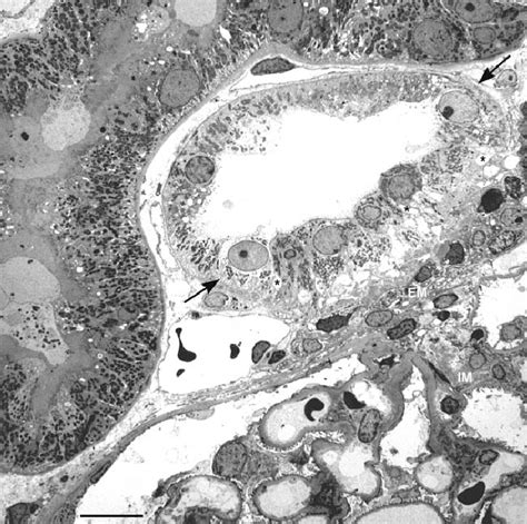 Extraglomerular Mesangial Cells