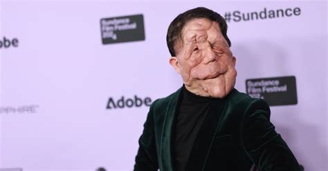 Is Adam Pearson Married And What Is He Up To Now