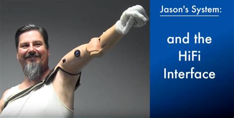 Jason S Bionic Arm Hifi Interface Coapt Lti Elbow I Limb Hand