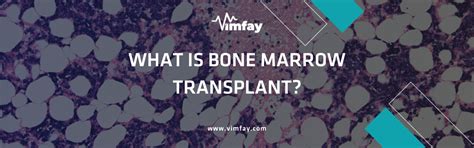 What Is Bone Marrow Transplant Stem Cell Transplant