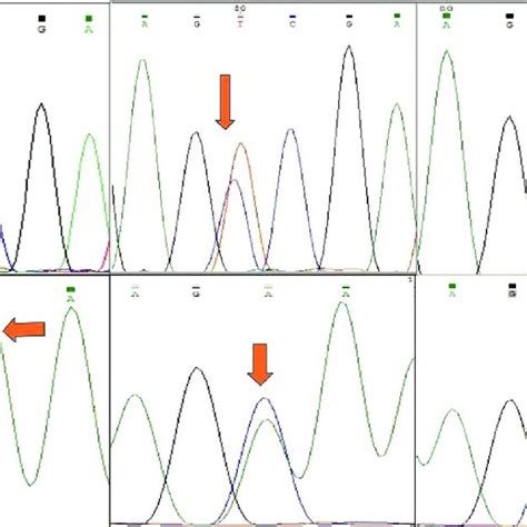 Representative Sequencing Chromatogram Profiles Of Controlscases