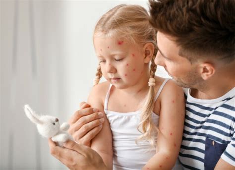 Що показує аналіз сечі та як його розшифрувати — блог медичного центру ОН Клінік