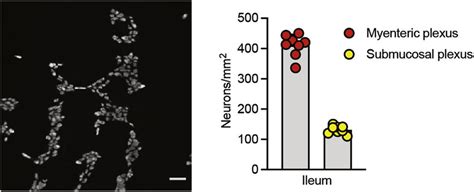 Neuronal Quantification In The Ileum Myenteric And Submucosal Plexus Download Scientific