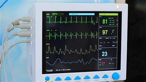 contec cms8000 patient monitor our rv adventures
