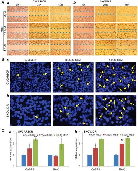 Antiparasitic Mebendazole Mbz Effectively Overcomes Cisplatin