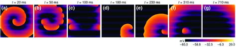 Termination Of Spiral Waves By Transient Breakup With Spatiotemporal Download Scientific