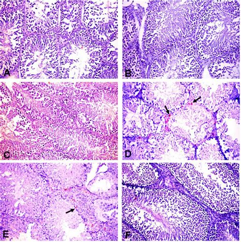 Caspase 3 Expression In Testes Of Different Experimental Groups Hande