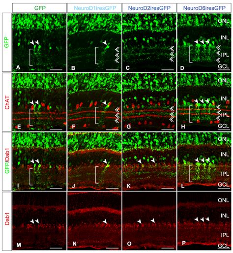 Stratification Of Neuronal Processes In The Ipl At P21 After