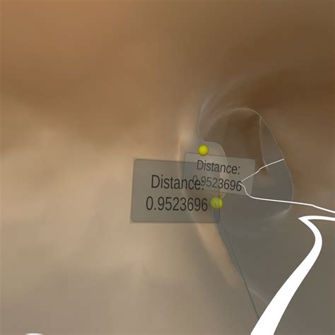 Distance Measurement Tool To Size The Anomalies Download Scientific