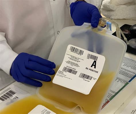jennifer widge on linkedin my veins are not able to do platelets but