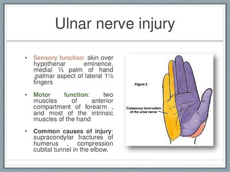 Peripheral Nerve Injuries