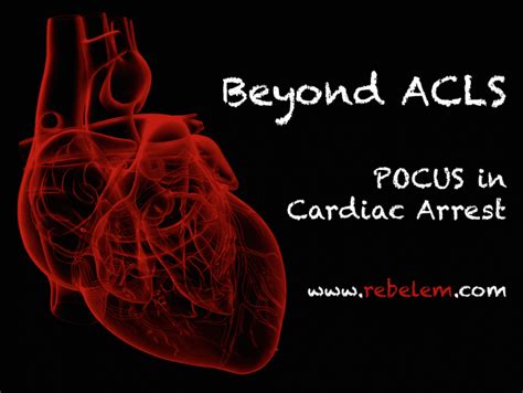 Beyond Acls Pocus In Cardiac Arrest Rebel Em Emergency Medicine Blog