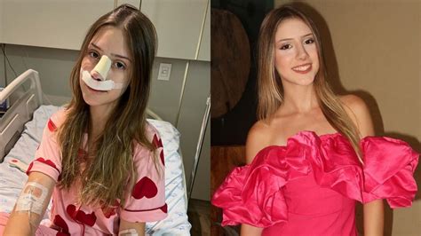 Estrela do TikTok de 14 anos mostra resultado de cirurgia plástica e