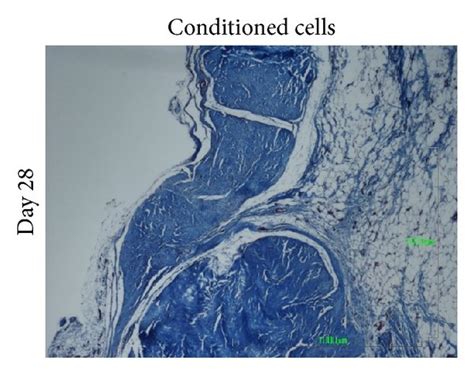 Histology Of Cross Sections At 7 A C And 28 Days D F A Hematoma Is