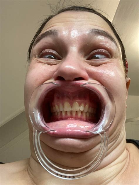 Pretty Ugly Vs Pretty Ugly Rprettygirlsuglyfaces