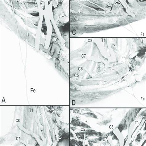 Terço Distal Da Região Cervical Vista Lateral Direita De Ovino Da Download Scientific Diagram