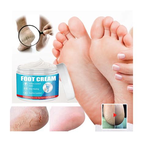 〖roliyen〗pro Beauty Tools Foot Care Foot Cream Healing Foot Repair