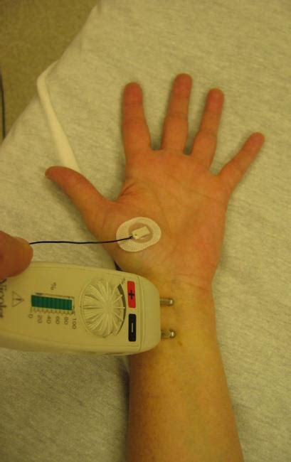 The Armdoc Carpal Tunnel Syndrome