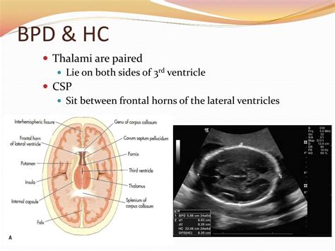 Ppt Obstetrical Measurements 2 Nd And 3 Rd Trimester Powerpoint