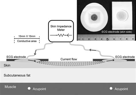 Mismatch Of Electrocardiogram Ecg Electrodes And Acupoints The Ecg
