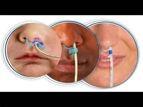 Video Nasal Bridle Youtube