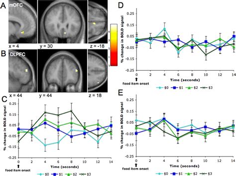 Orbitofrontal Cortex Encodes Willingness To Pay In Everyday Economic Transactions Journal Of