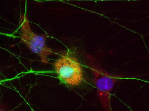 RNA FISH For Neuroscience LGC Biosearch Technologies