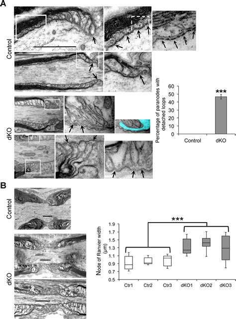 Detached Paranodal Loops And Wider Nodes In Dko Electron Micrographs