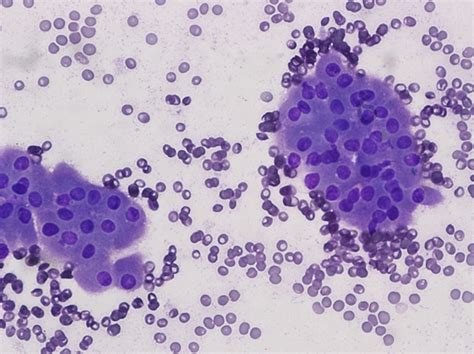 March 2013 The International Academy Of Cytology