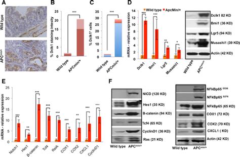 Dclk1 A Tumor Stem Cell Marker Regulates Pro Survival Signaling And