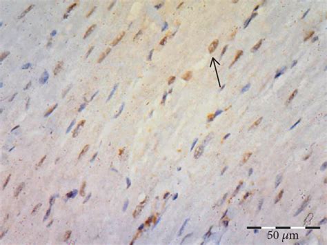 Effect Of Paeonol Pae On Cardiac Caspase 3 Immunostaining In