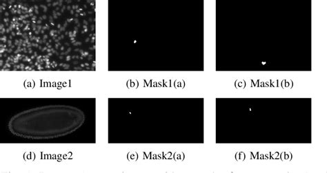 Figure 1 From Automatic Nuclei Segmentation Method Using Median Filter