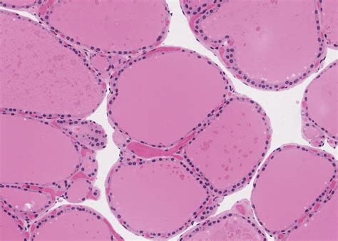 Endocrine System Meyers Histology