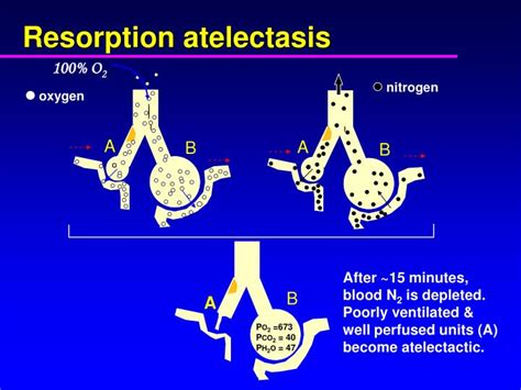 Ppt Oxygen Delivery Devices Powerpoint Presentation Id6601313