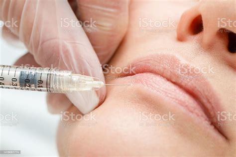 여성의 입술에 보톡스 주사를 만드는 미용사의 손을 감싼다 입술 모양 교정 입술 확대 개념에 대한 스톡 사진 및 기타 이미지 개념 건강관리와 의술 건강한 생활방식