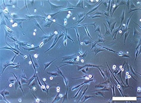 A Representative Photographs Of Adipose Mesenchymal Adipose Stem Download Scientific Diagram