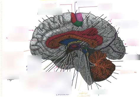 Medial Brain Image Diagram Quizlet
