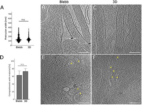 Novel Cryo Tomography Workflow Reveals Nanometer Scale Responses Of