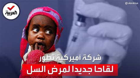 لقاح واعد لمرض السل في مراحل تجاربه الأخيرة Youtube